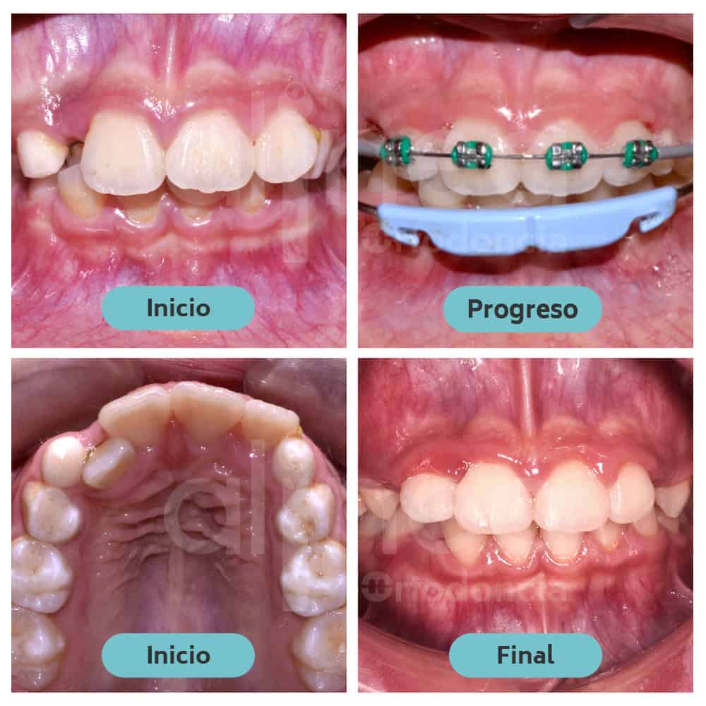 Alinea Ortodoncia – ALINEA VISION Y DENTAL