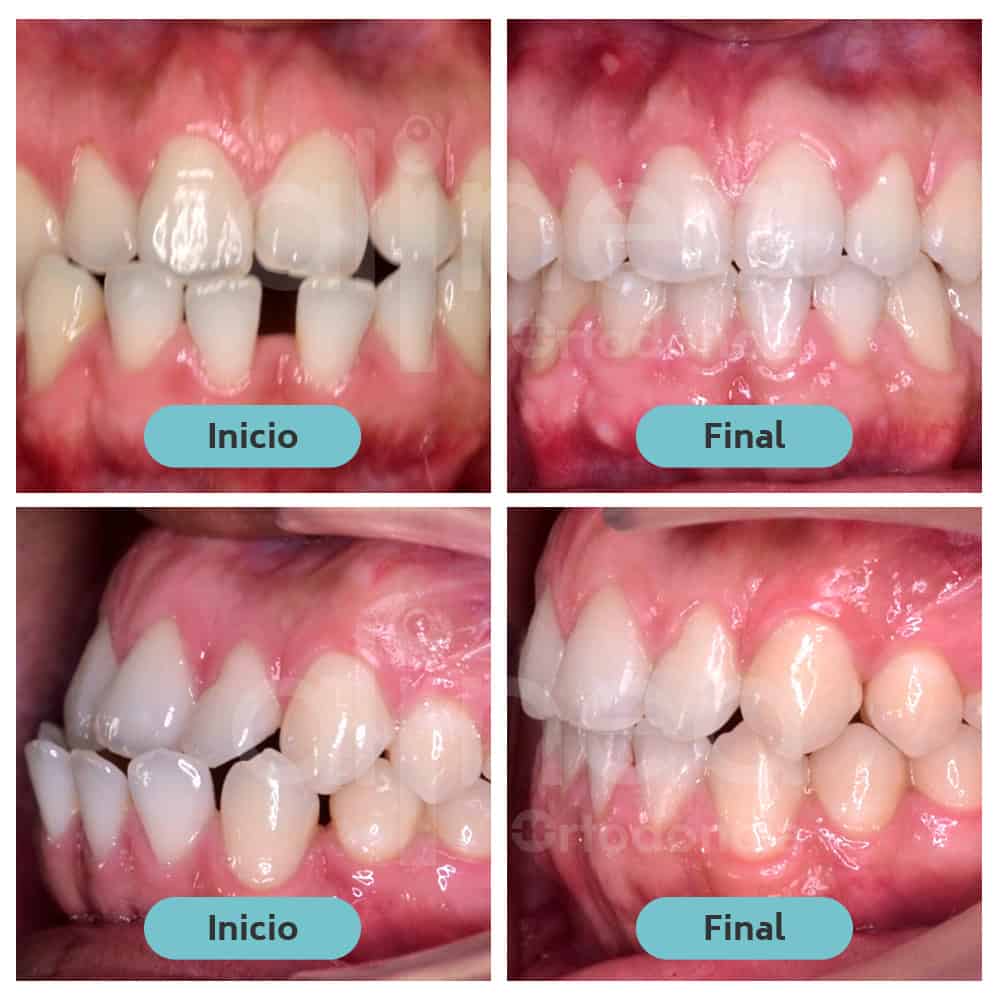 Alinea Ortodoncia – ALINEA VISION Y DENTAL