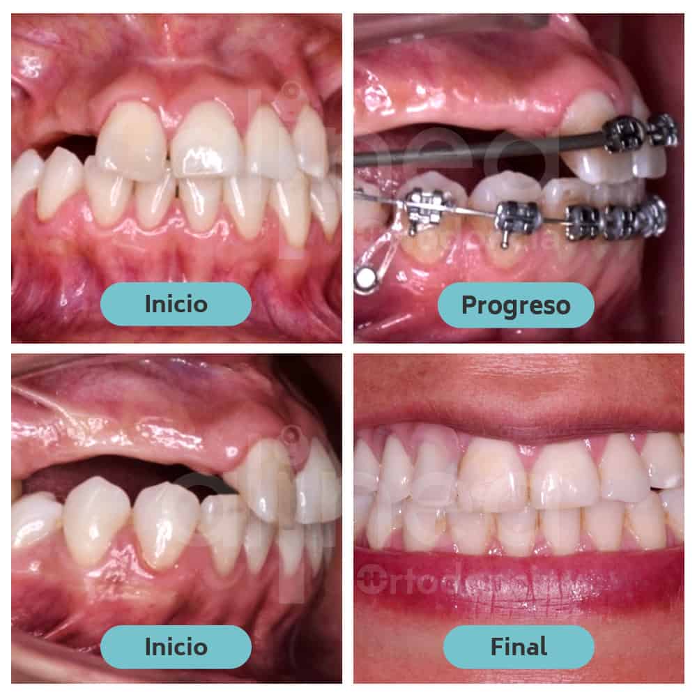 Alinea Ortodoncia – ALINEA VISION Y DENTAL