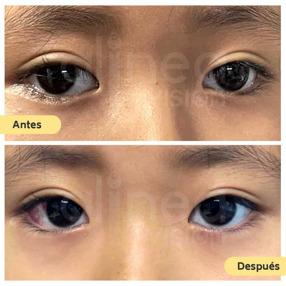visión – Clínica Alinea Visión y Dental en Lima